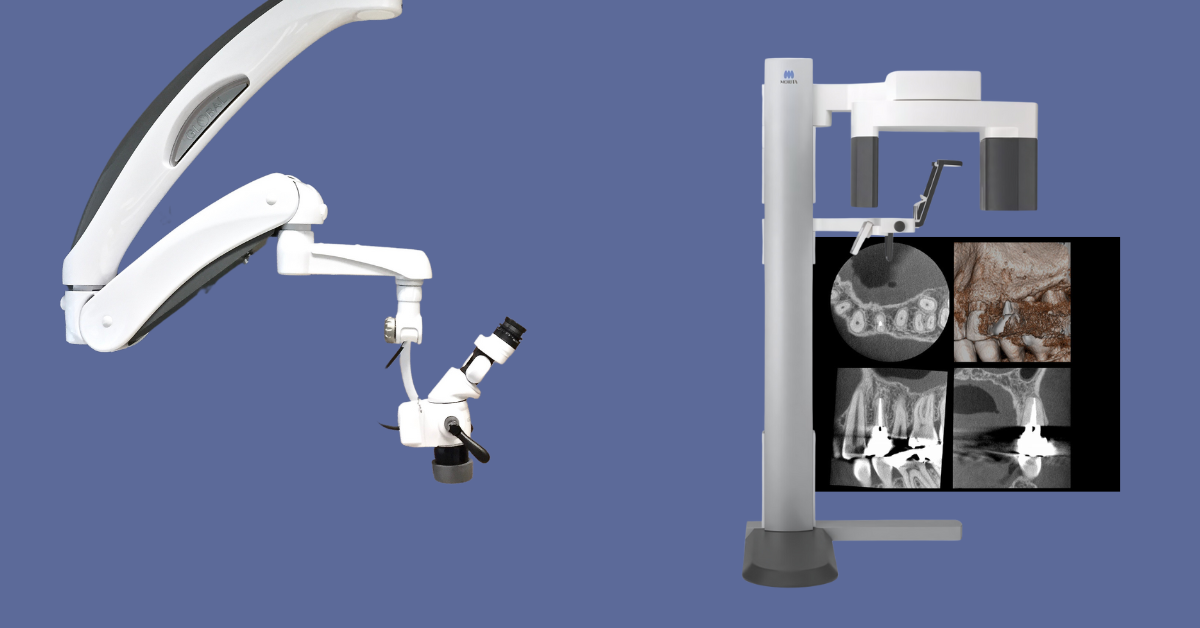 Digital Workflow in Endodontics: From Diagnosis to Final Restoration